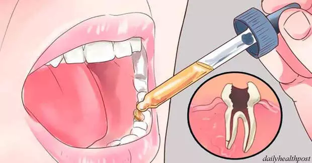 12 xeitos caseiros de aliviar a dor de dentes