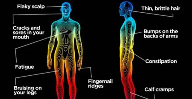 Deficiență de vitamine: 7 simptome importante despre care ar trebui să știți