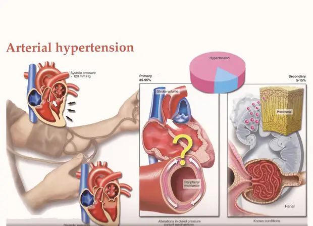 HYPERTENSJON og HORMONER: Hvordan normalisere blodtrykket