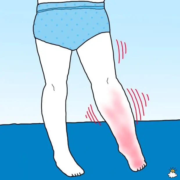 肿胀的腿：他们警告的8种令人担忧的疾病