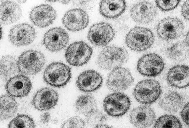 Fotografie virových částic HIV
