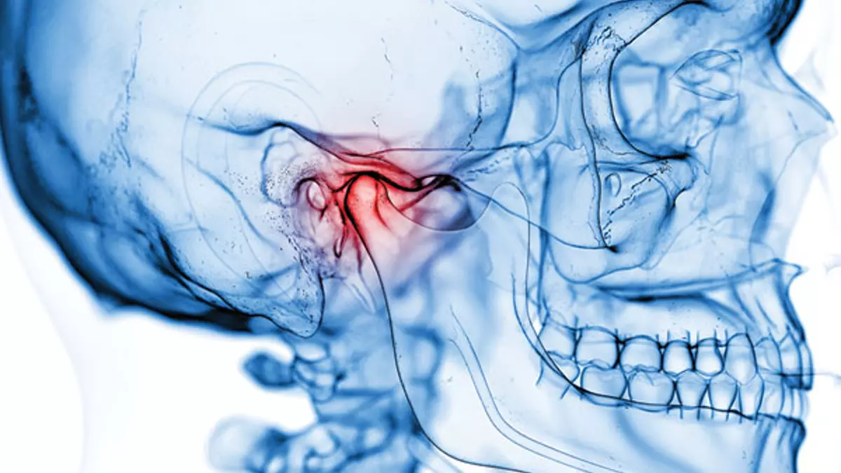 Nêrînek piçûk a felsefî li nexweşiyên movika temporomandibular