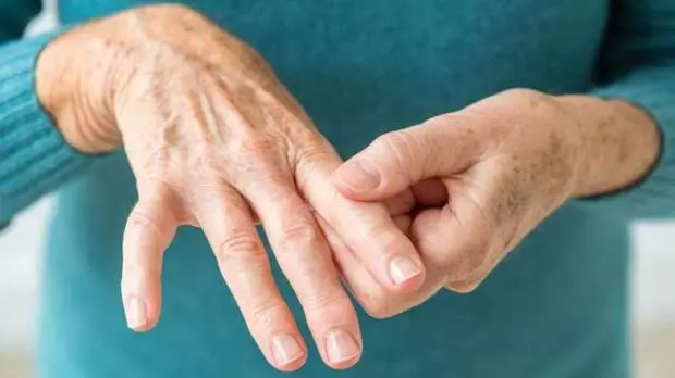 Arthritis rheumatoid: azo tsaboina, tsy azo sitranina. Saingy hiova tsy ho ela izany