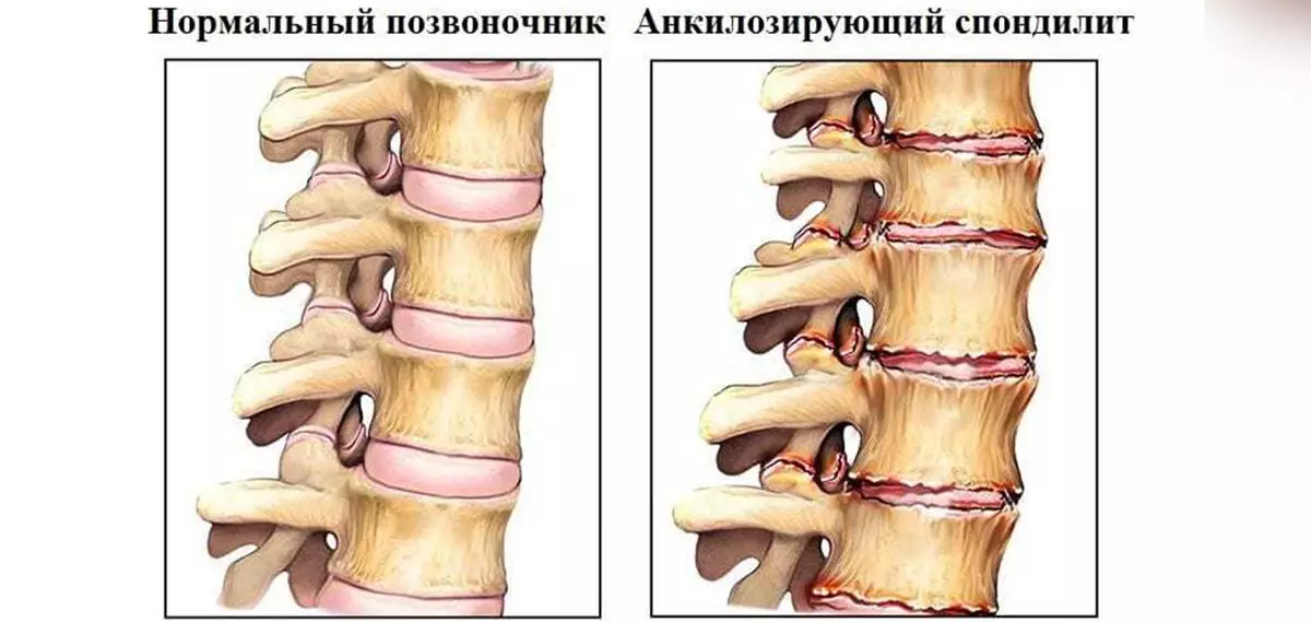 Слика са интернета.