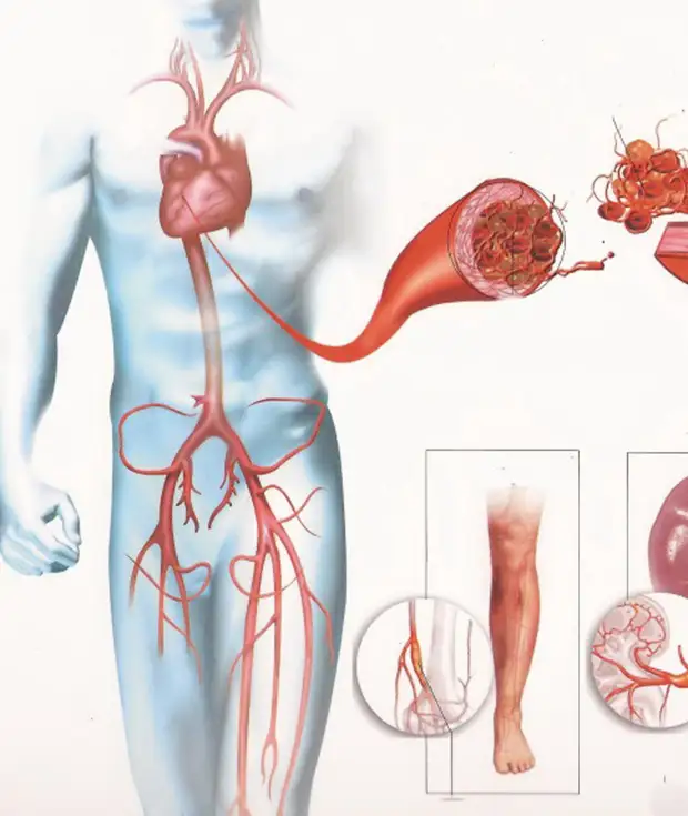 Glucosa en sangre elevada: 7 síntomas importantes