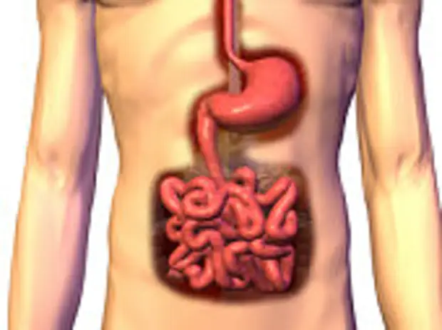 Disbiosi intestinal