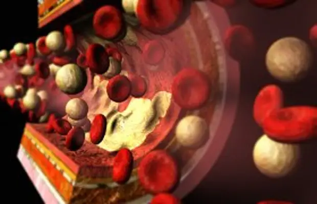Zenuwcellen verkregen uit menselijke spiercellen