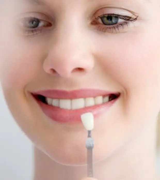 Novelties saka Dentistry modern: apa lan ngendi kanggo katon?
