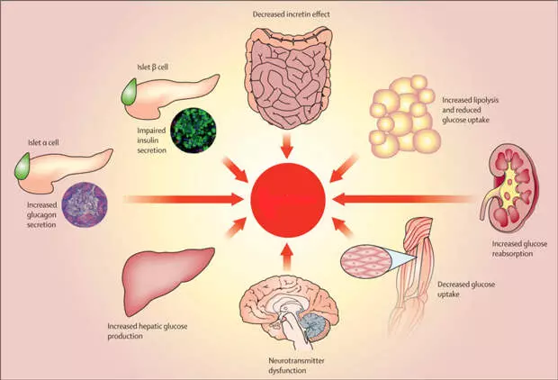 Sembilan Berbahaya: Apa yang mengancam overdosis vitamin ini?