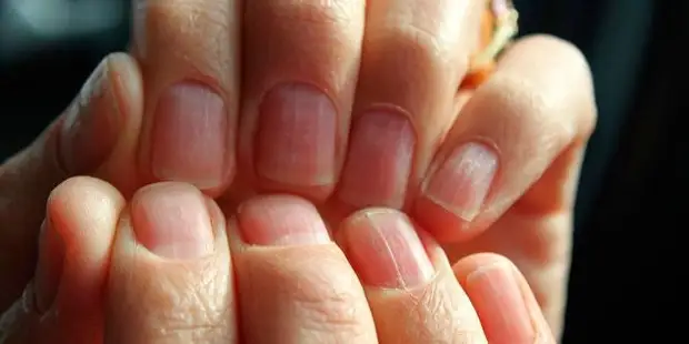 Com determinar l'estat de salut per les ungles (11 signes)