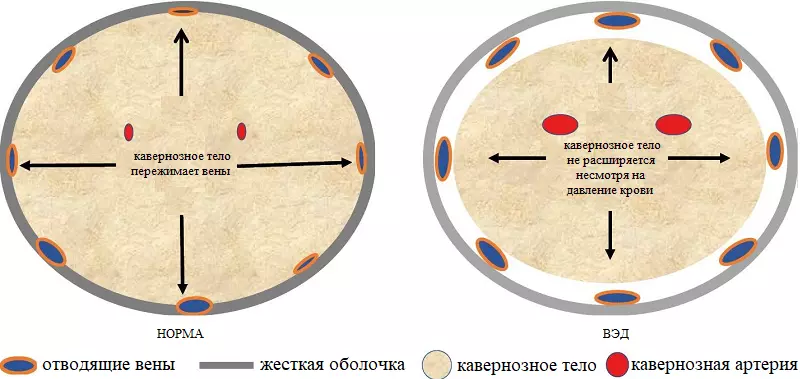 የሌሊት መገንባት - አቅም ማጣት መከላከል