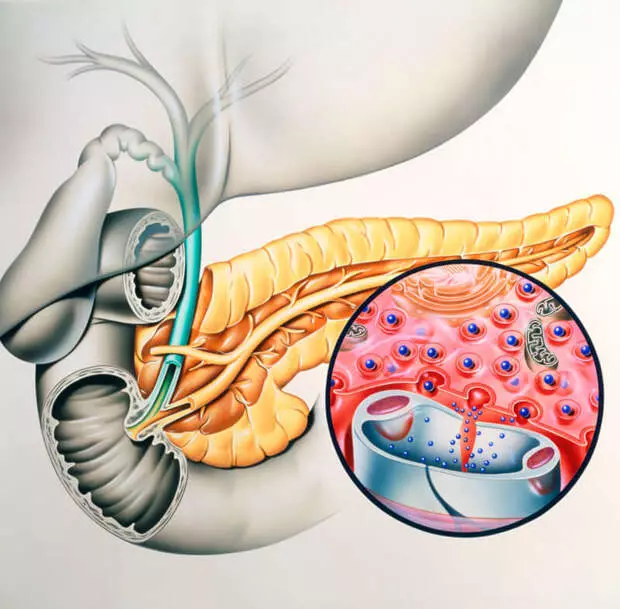 Панкрэатыт: практыкаванні для лячэння і папярэджанні