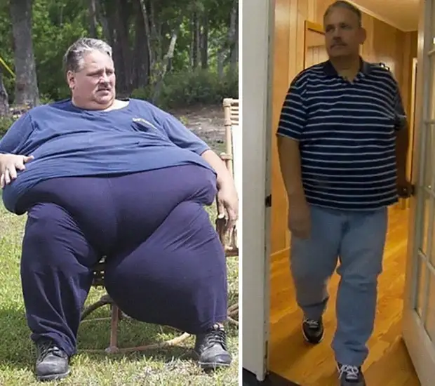 Billeder af mennesker, der har tabt sig mere end 100 kg