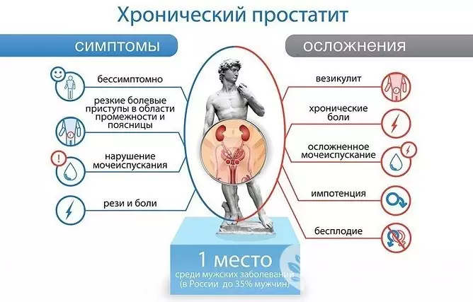 Posibles complicaciones de la prostatitis crónica.