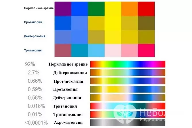 Түс сокурдугу: түс сокурдугунун түрлөрү