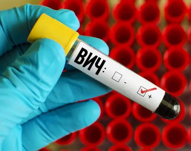 تەلەپتىكى ئوخشىمىغان پىكىردىكى رەسىملەر hiv