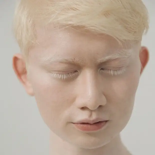 À quoi ressemblent les albinos de différentes nationalités et races