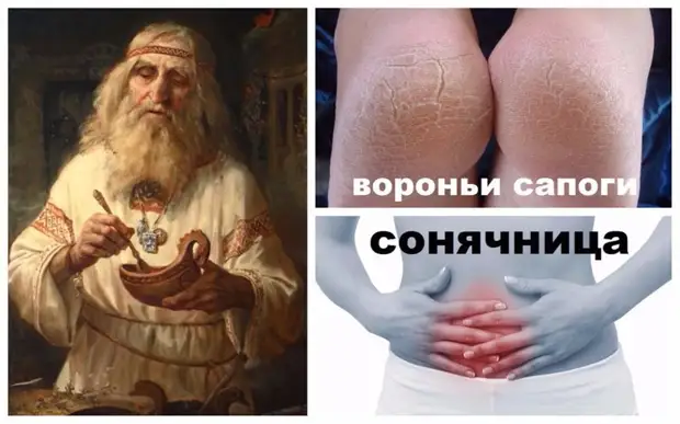 Dictionary of Russian Folk Ailments: Historical Names of Common Diseases