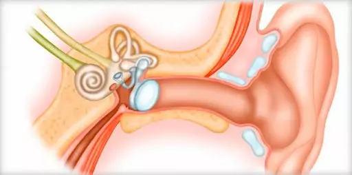 Vatten i örat. Hur man blir av med, om det inte kommer ut på en vecka efter badet, det gör ont, vad man ska göra, mediciner