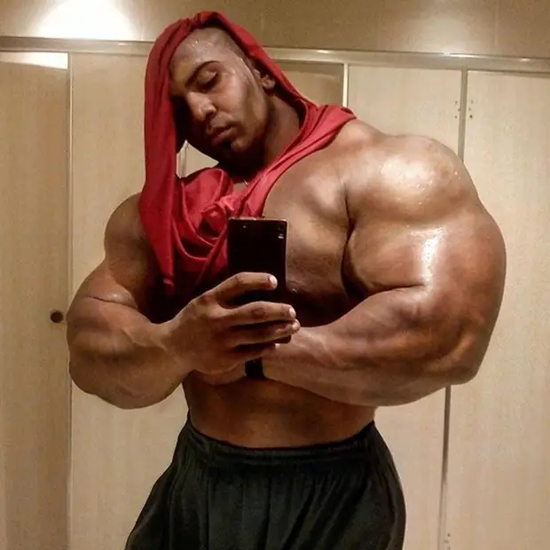 But what happens to a person when there is enough money for synthol for the whole body Synthol, hypertrophy, stop them already, too much, overdone, pseudo-pumping, swinging, synthol
