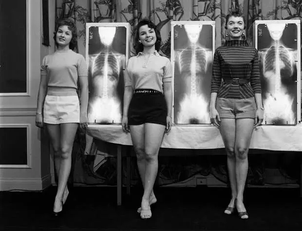 Rentgenstari, svērteni un svari: kā viņi izvēlējās "Miss Pareizo stāju" 50. gados