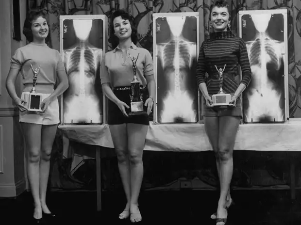 Röntgenfoto's, schietlood en weegschaal: hoe ze in de jaren 50 voor "Miss Correct Posture" kozen