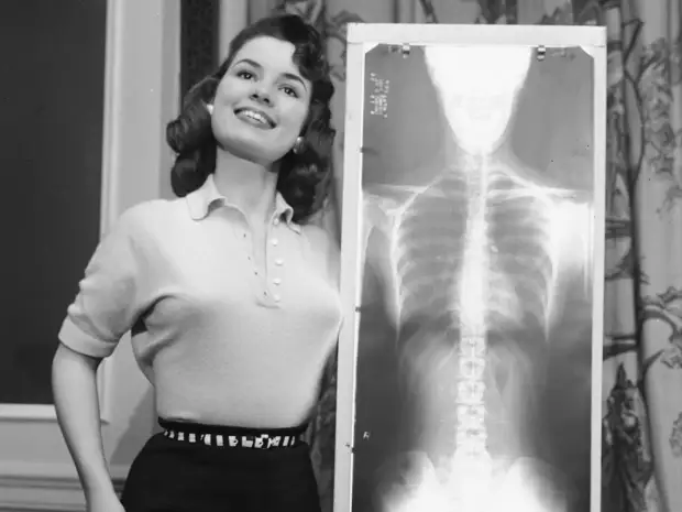 Radiografie, filo a piombo e bilancia: come scelsero "Miss Correct Posture" negli anni '50