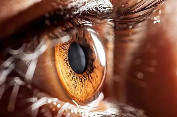 Kanker, penyakit kuning, kelebihan kolesterol. Masalah kesehatan apa yang ditimbulkan oleh mata?