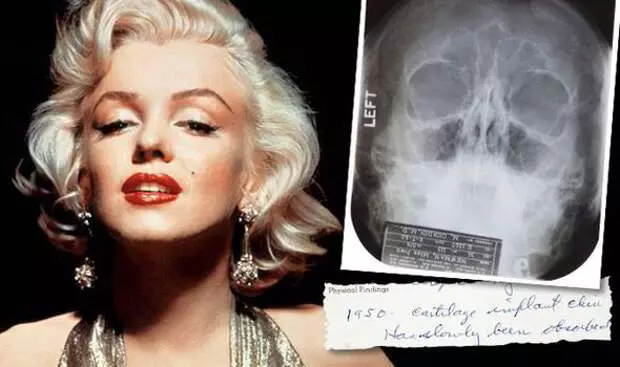 Ono što je bila plastična kirurgija u Hollywoodu prije sedamdeset godina