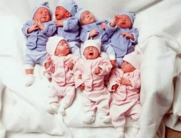 Anak kembar pertama di dunia berusia tujuh belas tahun (7 foto)