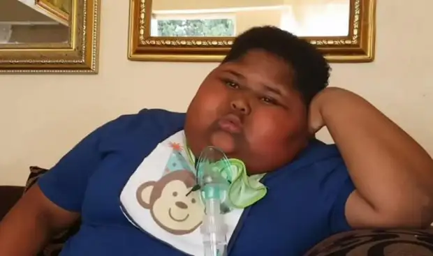 "Als er geen eten in huis is, begint het kind papier te eten": een jongen die op 3-jarige leeftijd 40 kg woog
