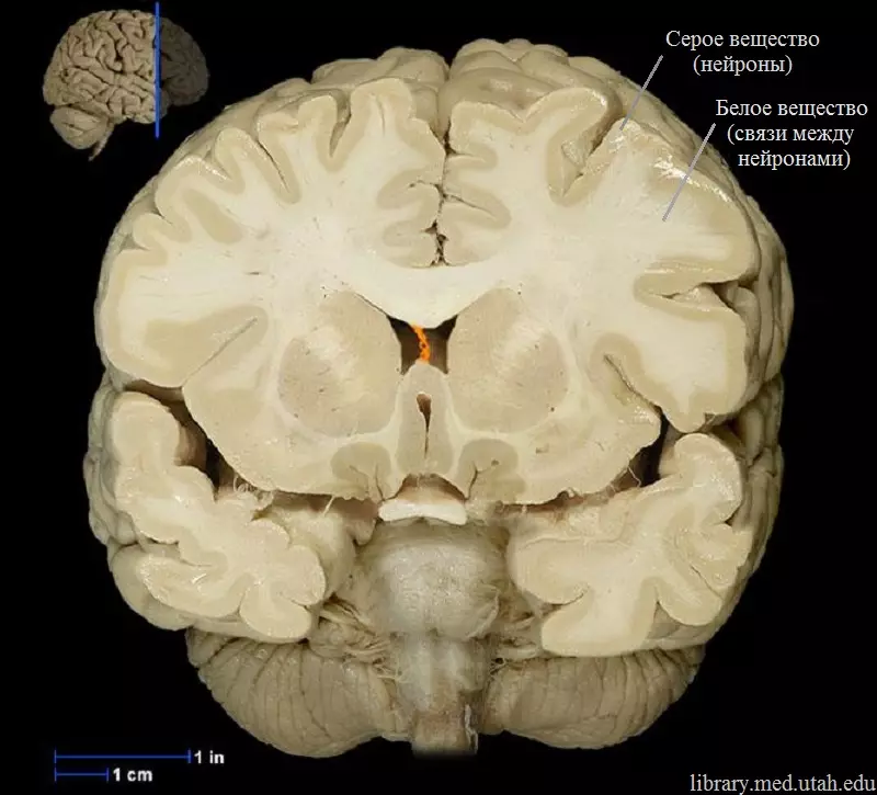 bracorbradicseptumpellucidum-142721E8C975DD071DF.jpg