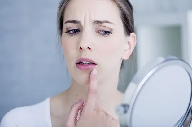 Come curare rapidamente un raffreddore sul labbro: metodi di trattamento, prevenzione e rimedi per l'herpes