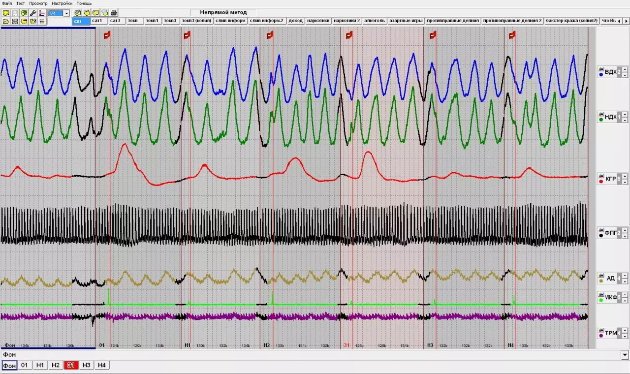 Lo mtshina wamanga onenkohliso noma inganekwane ye-polygraph