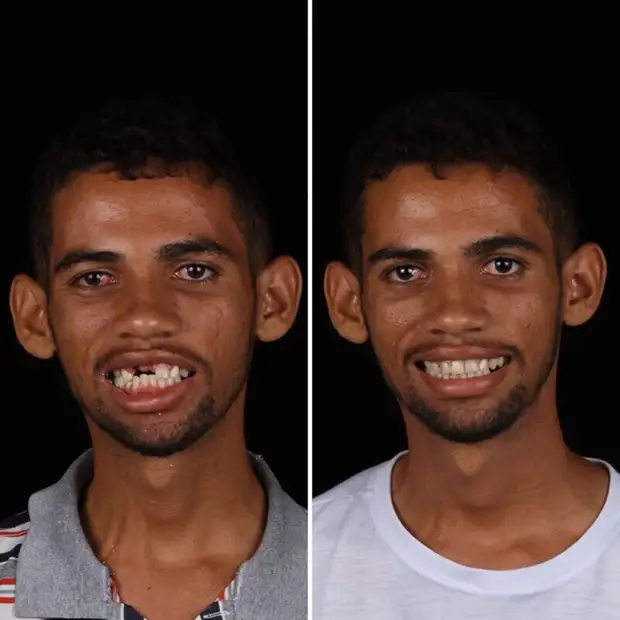 Bác sĩ giúp những người có nhu cầu trả lại nụ cười cho cả 32 chiếc răng