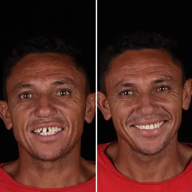 Il dottore aiuta chi ha bisogno a restituire il sorriso a tutti e 32 i denti