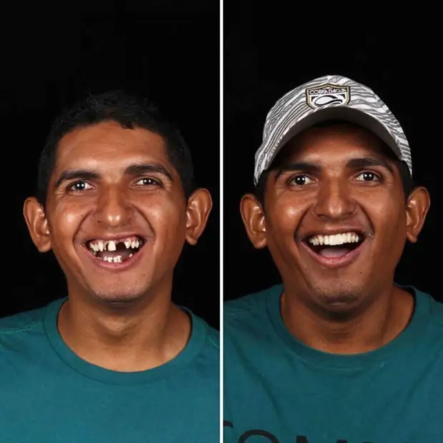 Läkaren hjälper de behövande att få tillbaka ett leende till alla 32 tänderna