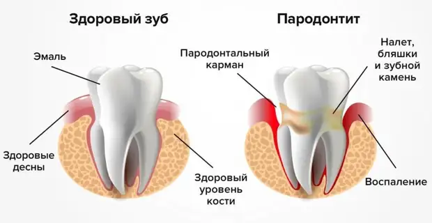 Jednoduchý způsob, jak si udržet zdravé zuby až do vysokého věku