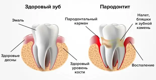 Просты спосаб захавання здароўя зубоў да старасці