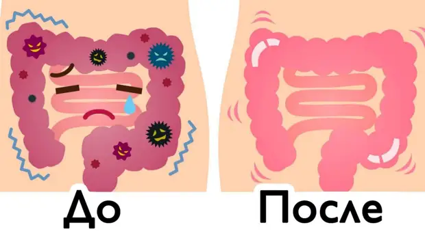 Imágenes para limpiar el sistema digestivo.