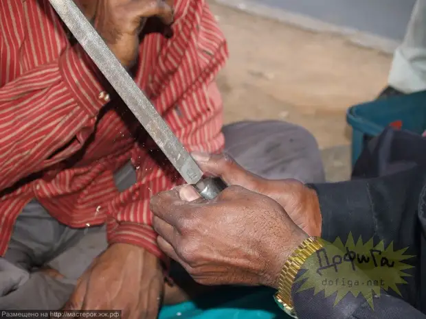 Como traballan os dentistas na India