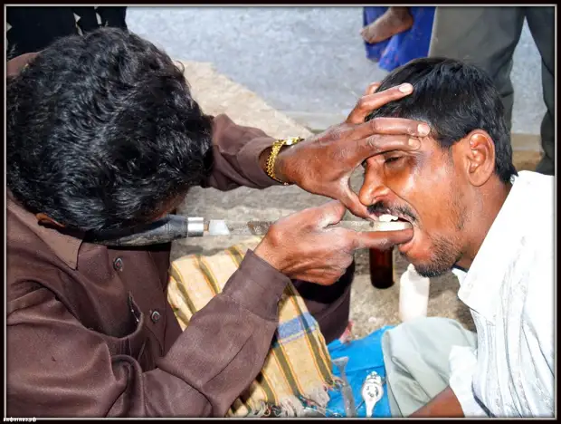 Como traballan os dentistas na India