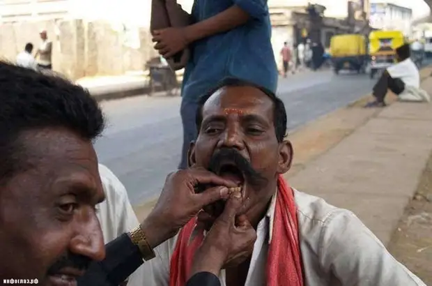 Como traballan os dentistas na India