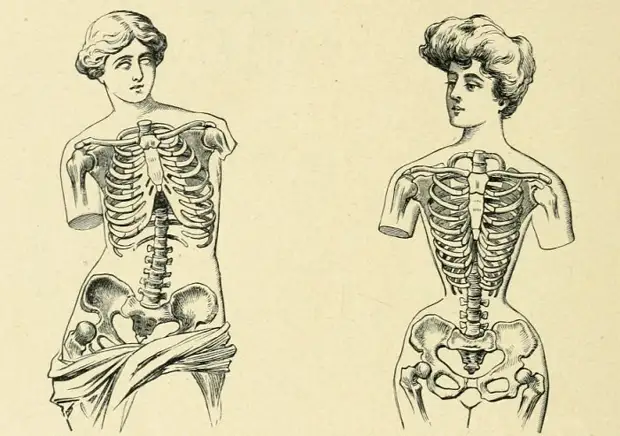 Comment le corps se déforme lorsqu'on porte un corset. | Photo : blog.polona.pl.