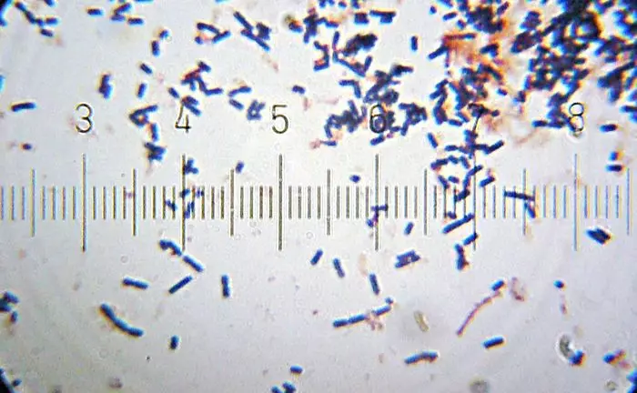 Ano ang amoy ng ari? Mahiwagang Slime Biome. Gamot, Puki, Impeksiyon, Scientaevulgaris, Longpost