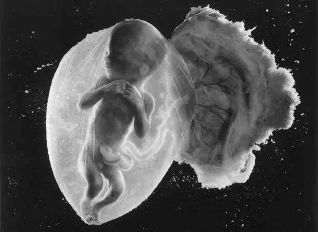 Embrio, 18 Minggu: Mungkin Gambar Terhebat Abad ke-20