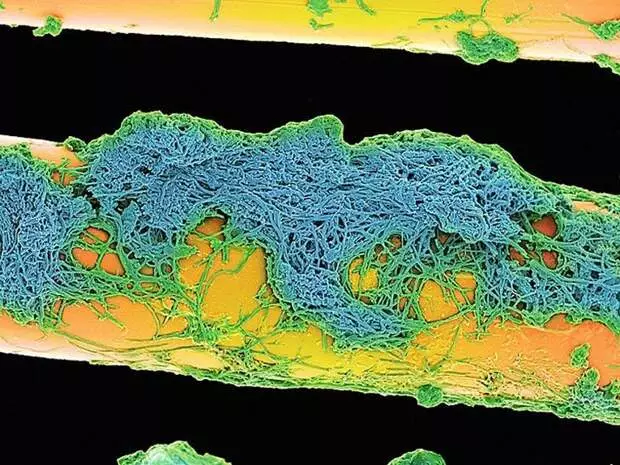 Cosa c'è nella tua bocca, molto in primo piano