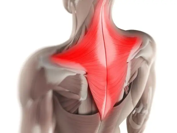 Spierklemme van die nek en rug: verlig pyn deur postuur te verander