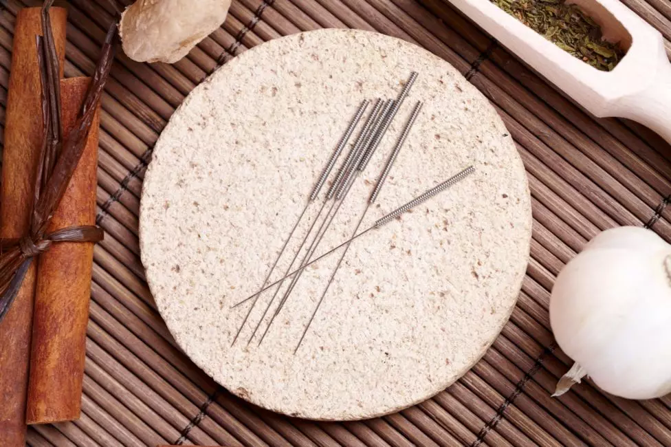 Sindano za acupuncture