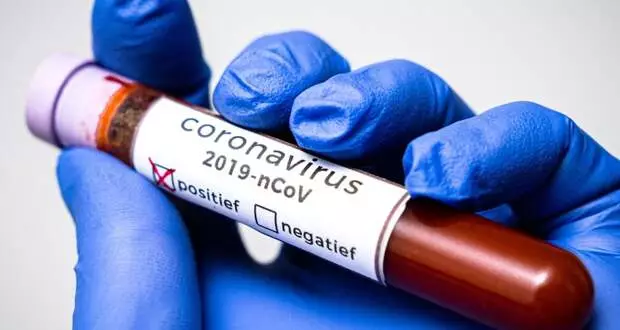 La vivdaŭro de la koronavirus sur pordaj teniloj kaj necesejoj estis determinita
